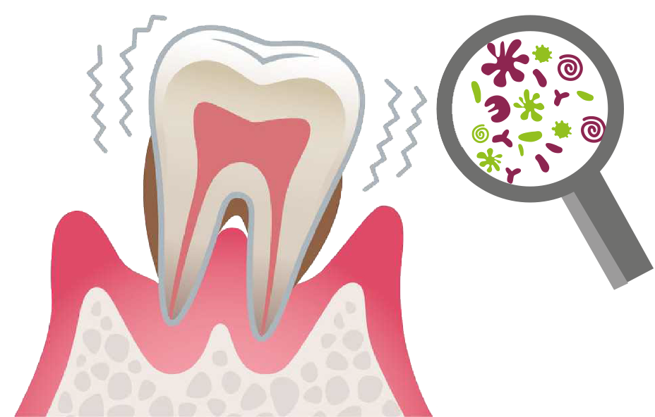 iai Tests - Parodontitis Diagnostik und Prophylaxe - IAI Testsysteme